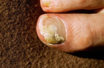 Best Nail Clippers, Best Foot Care and Best Nail Care - Nail Clippers ...